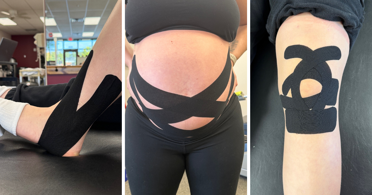 Kinesio Taping: Your Easy Guide to Dynamic Support - Carolina Physical ...